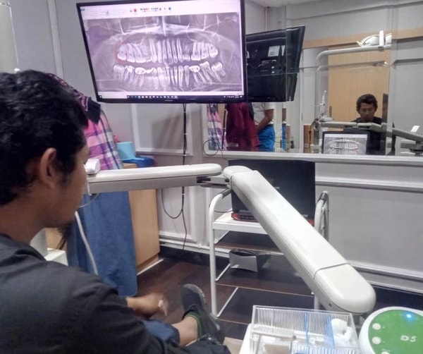 Layanan Cabut Gigi Bungsu dengan Spesialis Bedah Mulut